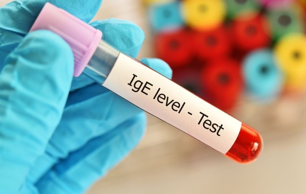 Allergy test: Identifying your allergy triggers for better control